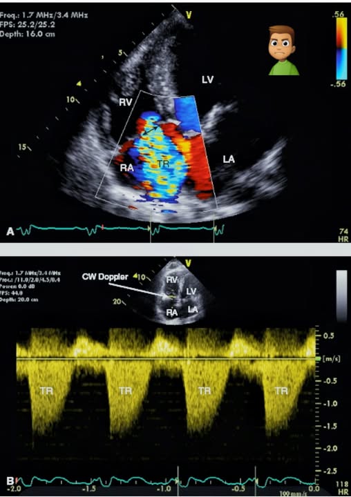 Adult Echocardiography – ultrasoundexpertsacademy.com